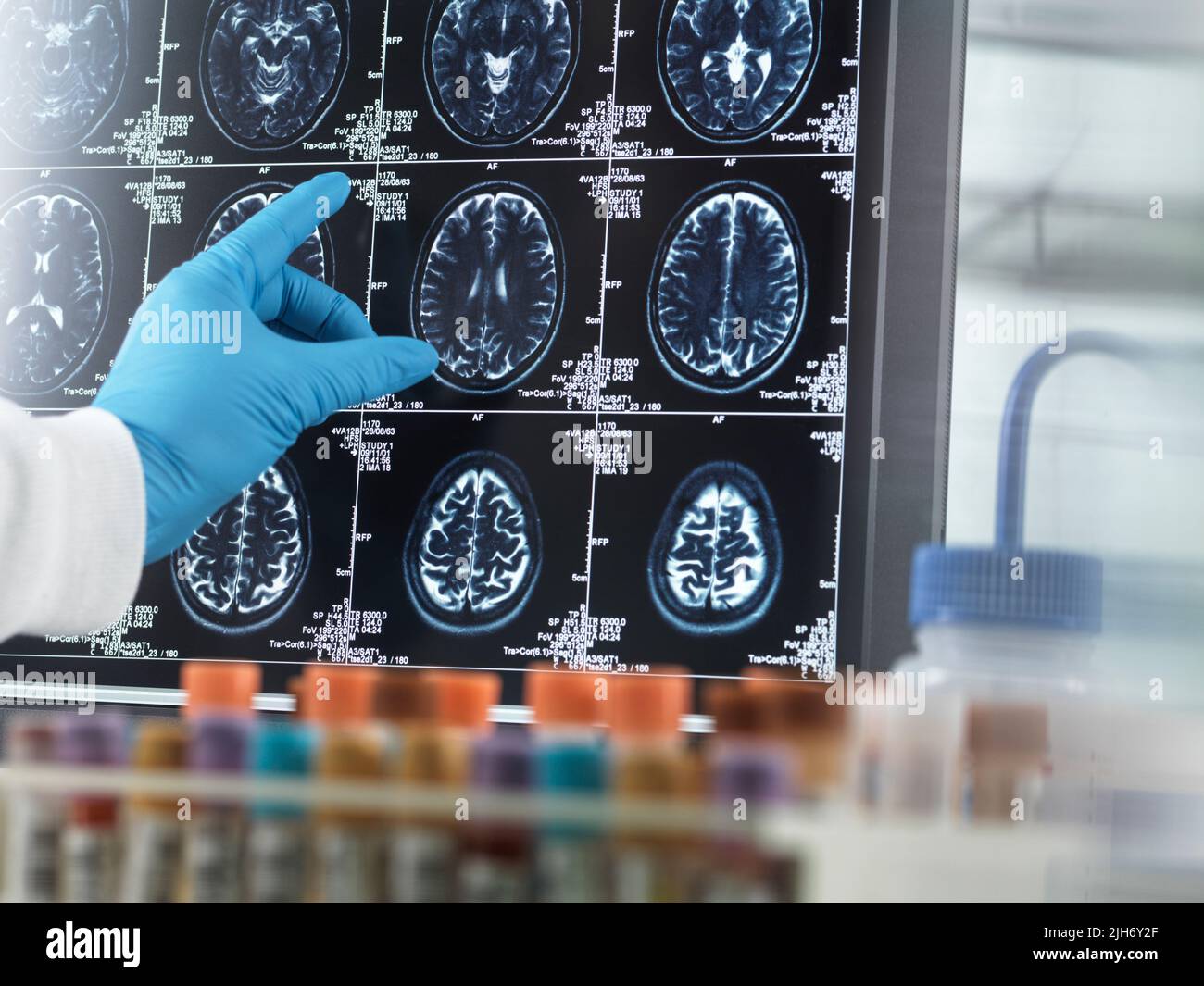 Alzheimer's and dementia research, conceptual image Stock Photo - Alamy