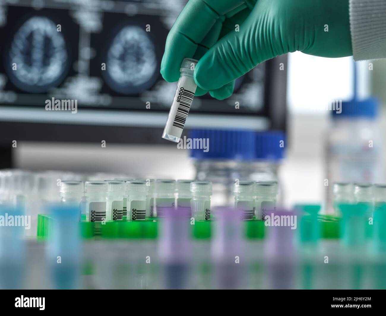 Alzheimer's and dementia research, conceptual image Stock Photo - Alamy