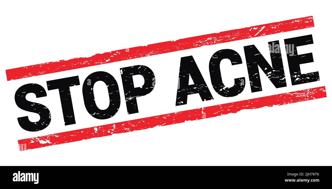 STOP ACNE text written on black-red rectangle stamp sign Stock Photo ...
