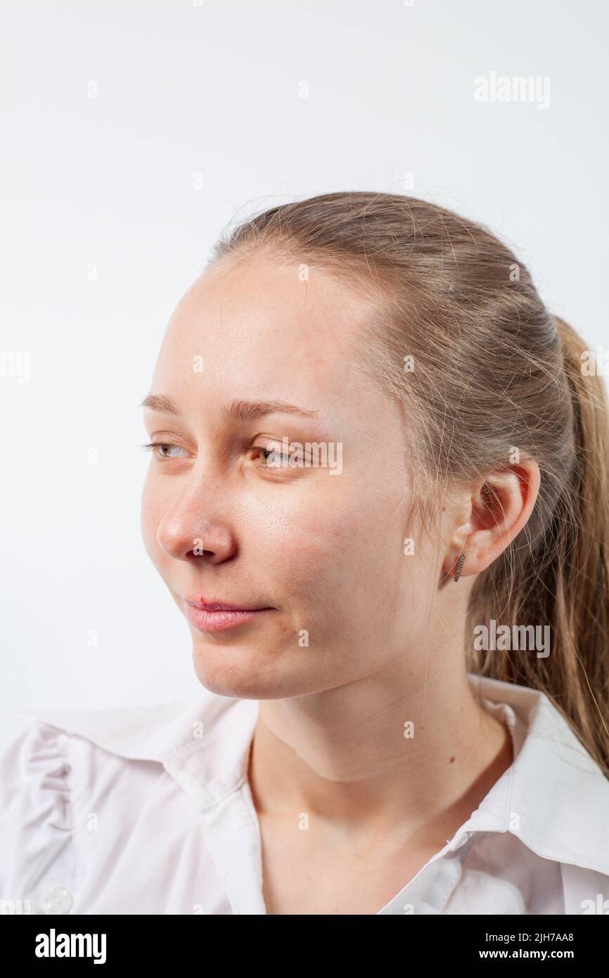 The girl drips nose drops from a runny nose with influenza Stock Photo ...