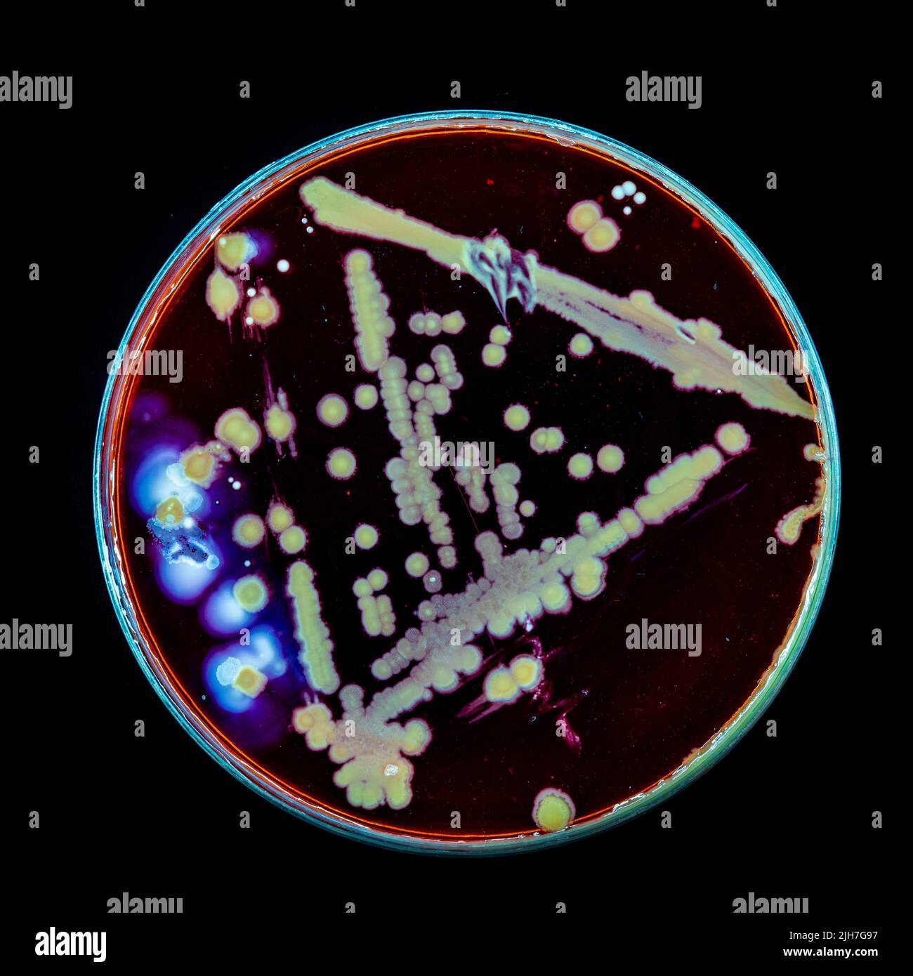 Samples of Petri dishes with a culture of microorganisms and fungi in the surface of agar ...