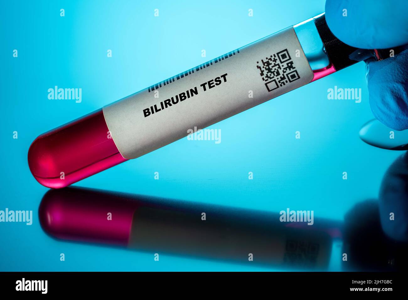 Bilirubin Test Blood Tests for Older Adults. Recommended Blood Test for ...