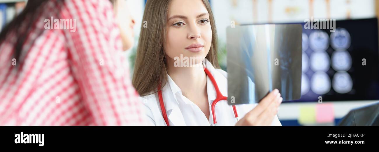 Clever professional doctor examine x ray result on appointment, show ...