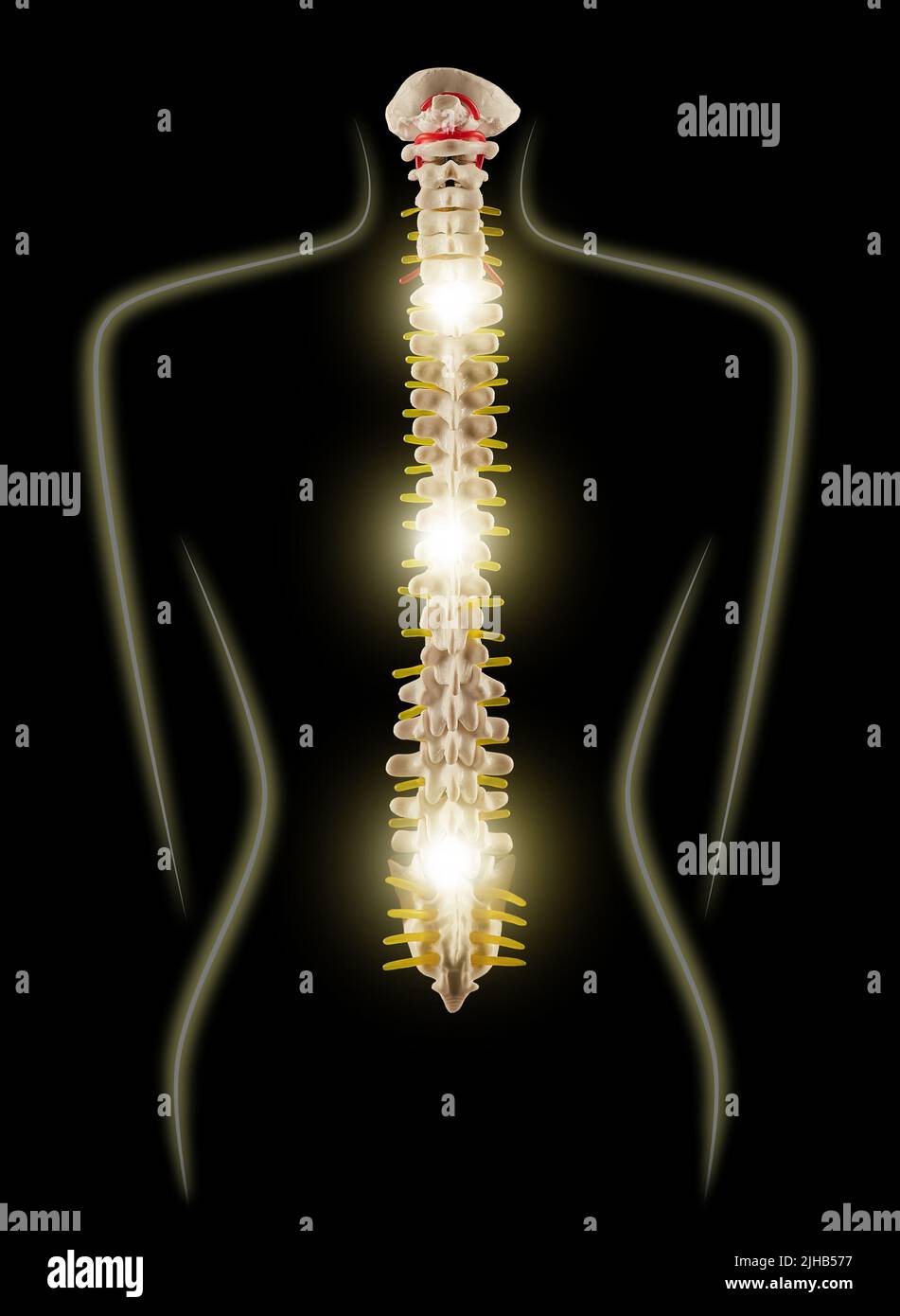 Spine health. Woman silhouette with glowing spine showing backbone ...