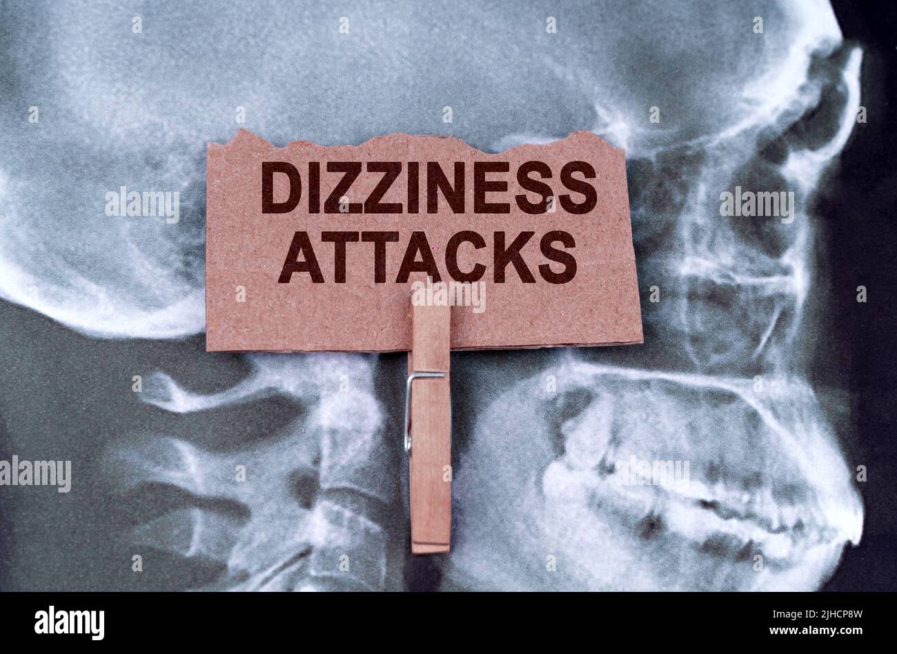 Medicine concept. Against the background of an X-ray of the skull, a ...