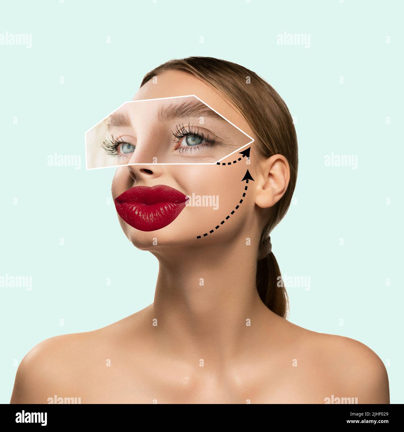 Contemporary art collage. Young woman making face lifting with plastic ...