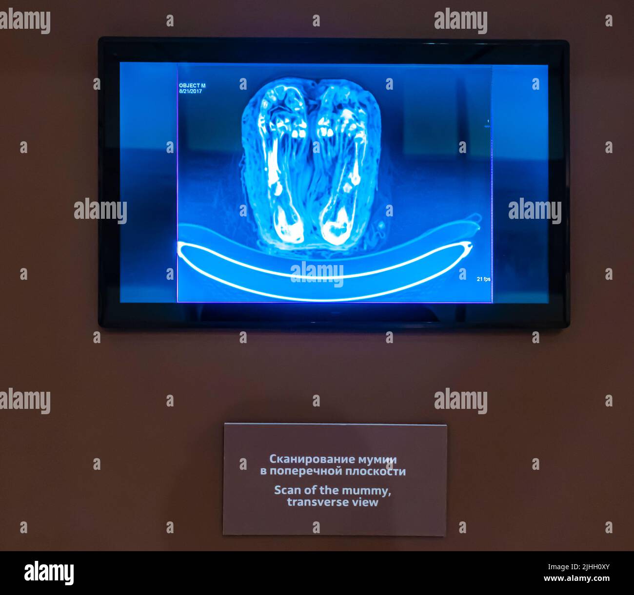 MRI scans of an ancient Egyptian mummy from the Hermitage museum in St ...