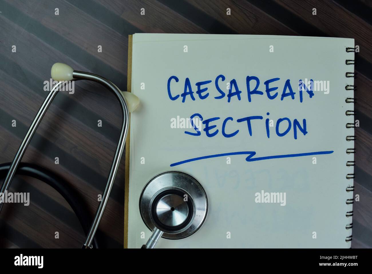 Cesarean section illustration hi-res stock photography and images - Alamy