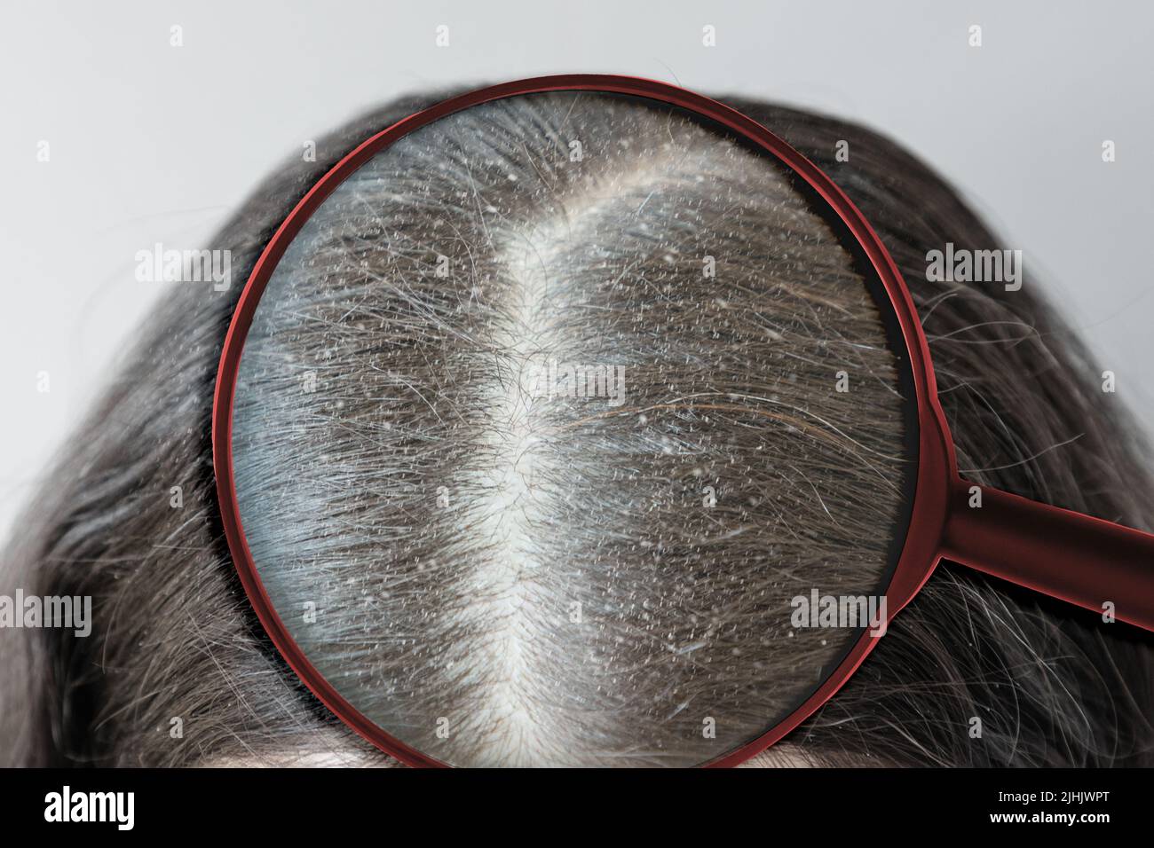 Close-up of the parting of brunette hair on the head covered with ...