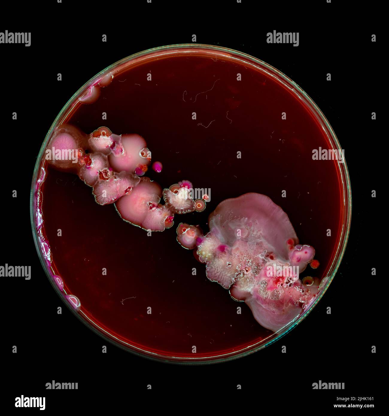 Samples of Petri dishes with a culture of microorganisms and fungi in the surface of agar ...