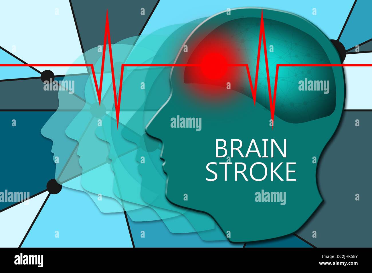 Human brain symbol of a stroke and circulation of the heart with pulse ...