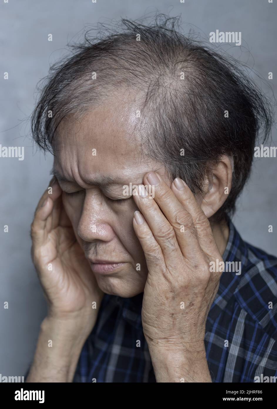 Shooting Pain From Eye To Temple at Hunter Wang blog