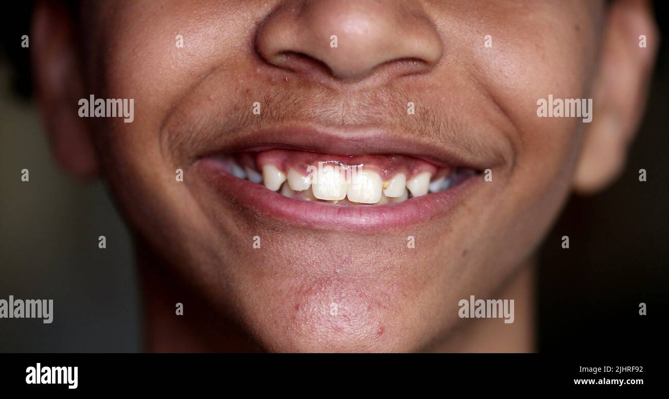Pre-teen young boy smiling, close-up child mouth teeth Stock Photo - Alamy
