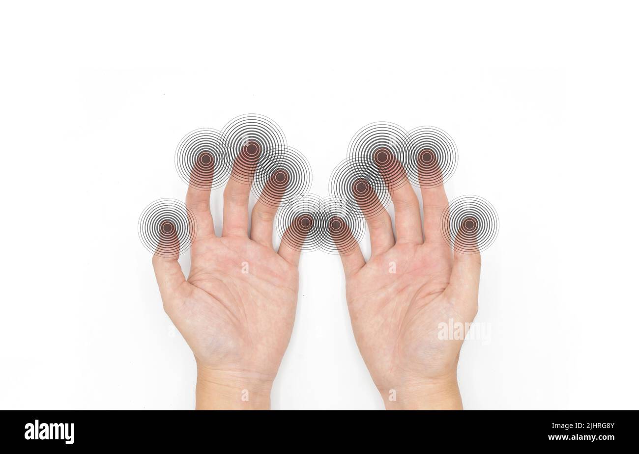 Tingling and numbness in fingertips of Asian young man with diabetes ...