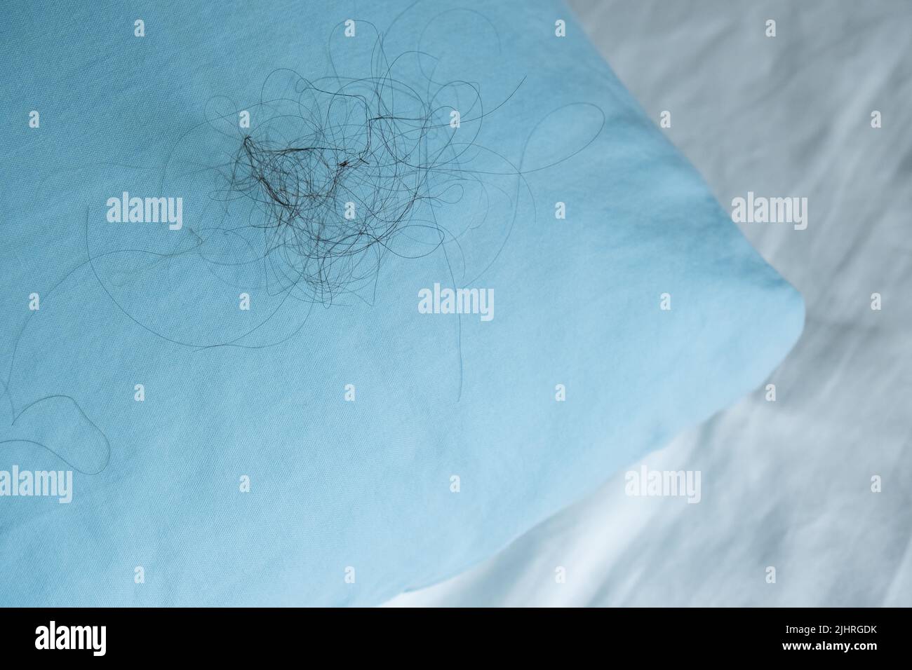 Fallen long hair on the blue pillow. Baldness problem Stock Photo - Alamy