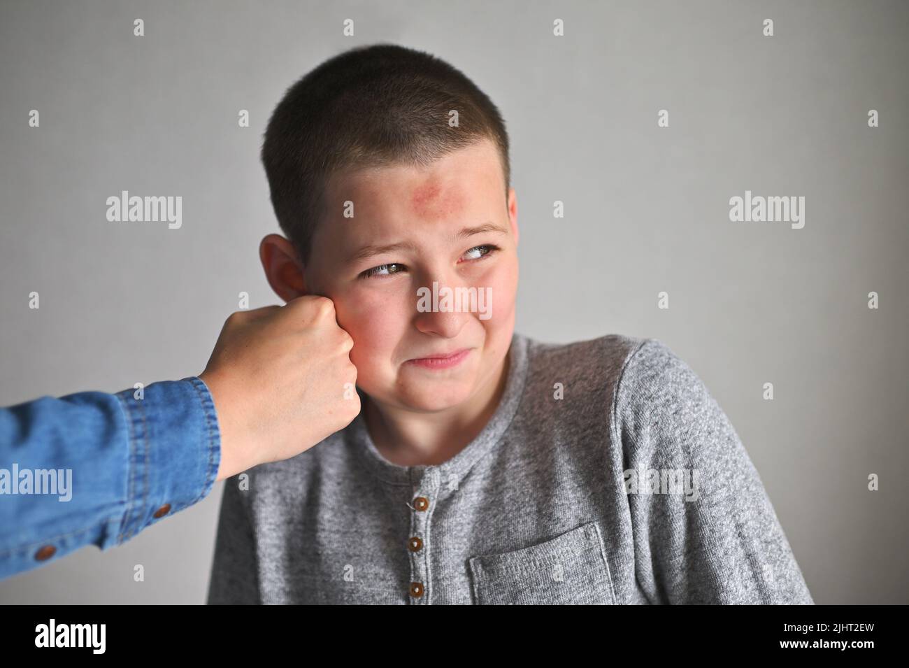 Fist of a parent near the face of a child with a bruise on his forehead ...