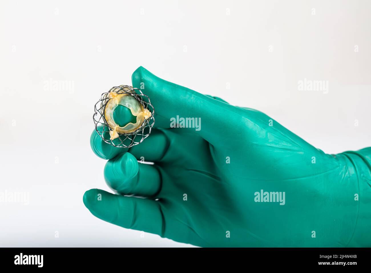 Heart valve surgery cardiology for patient in hospital. Prepare ...