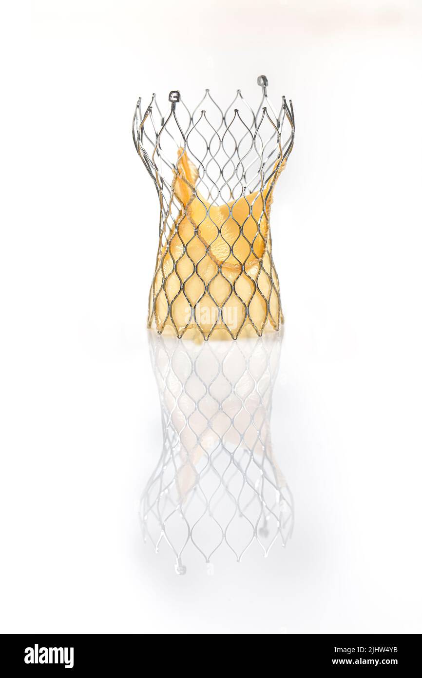 Heart valve surgery cardiology for patient in hospital. Prepare ...