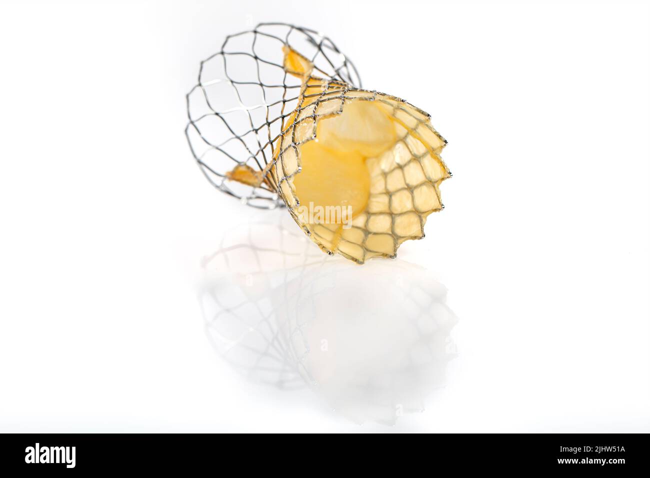 Heart valve surgery cardiology for patient in hospital. Prepare ...