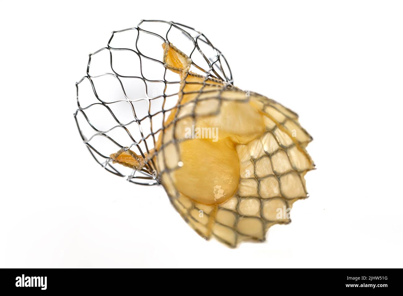 Heart valve surgery cardiology for patient in hospital. Prepare ...