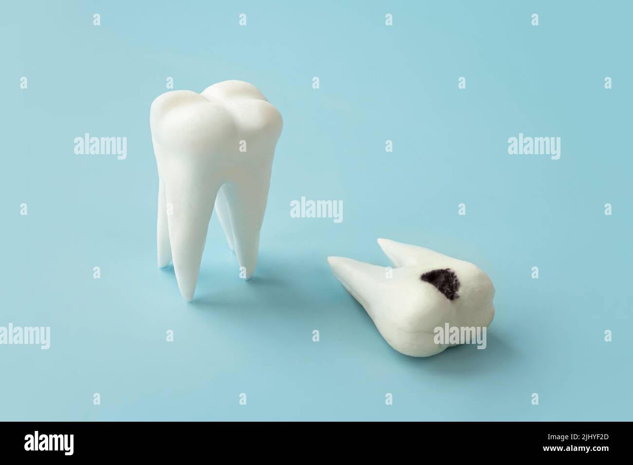 Teeth with bad sick damaged tooth on blue background. Decay, gum ...