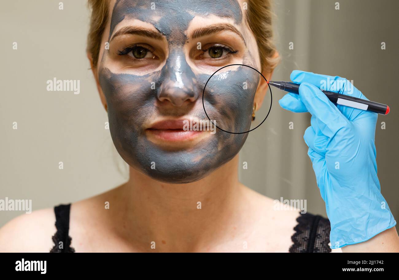middle aged woman with correction marks preparing for plastic surgery ...