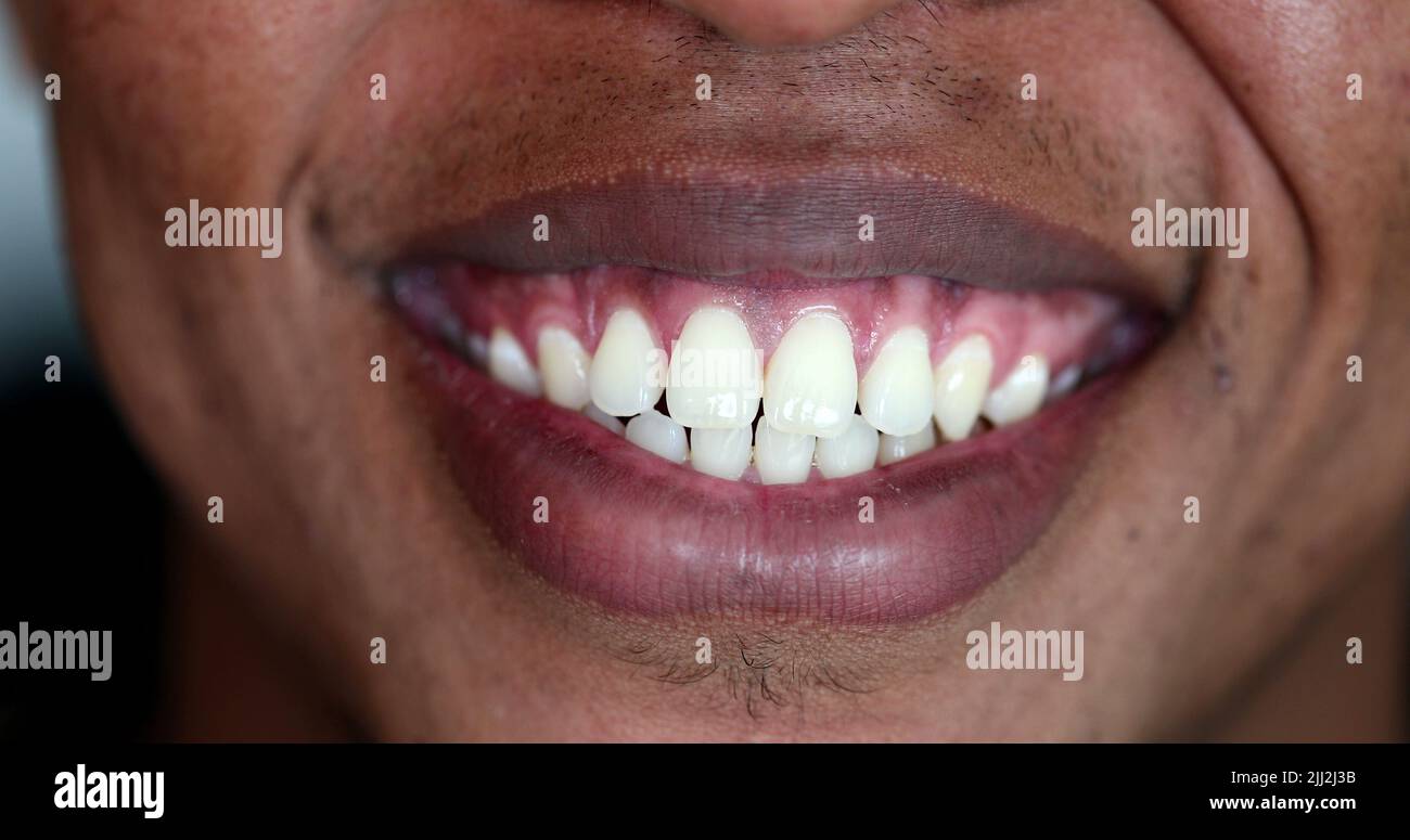 African person mouth smiling close-up, white teeth Stock Photo - Alamy