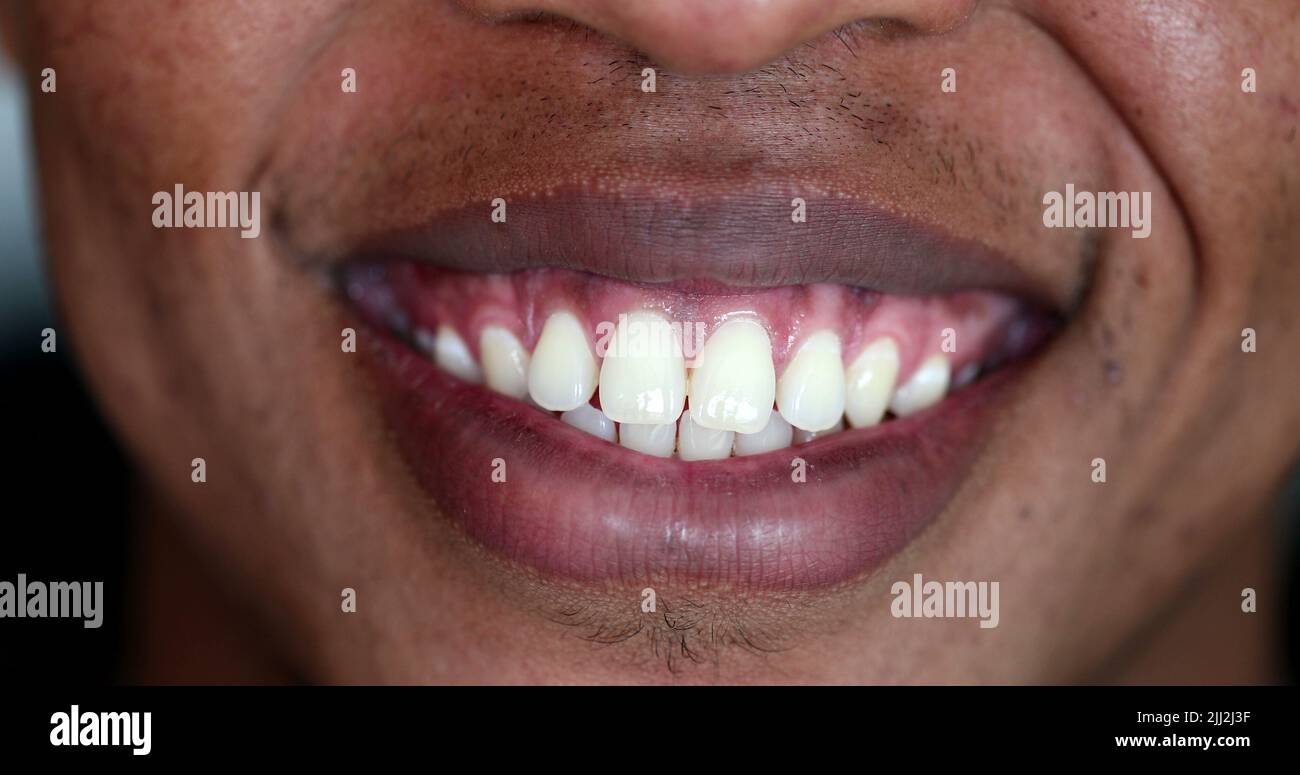 African person mouth smiling close-up, white teeth Stock Photo - Alamy