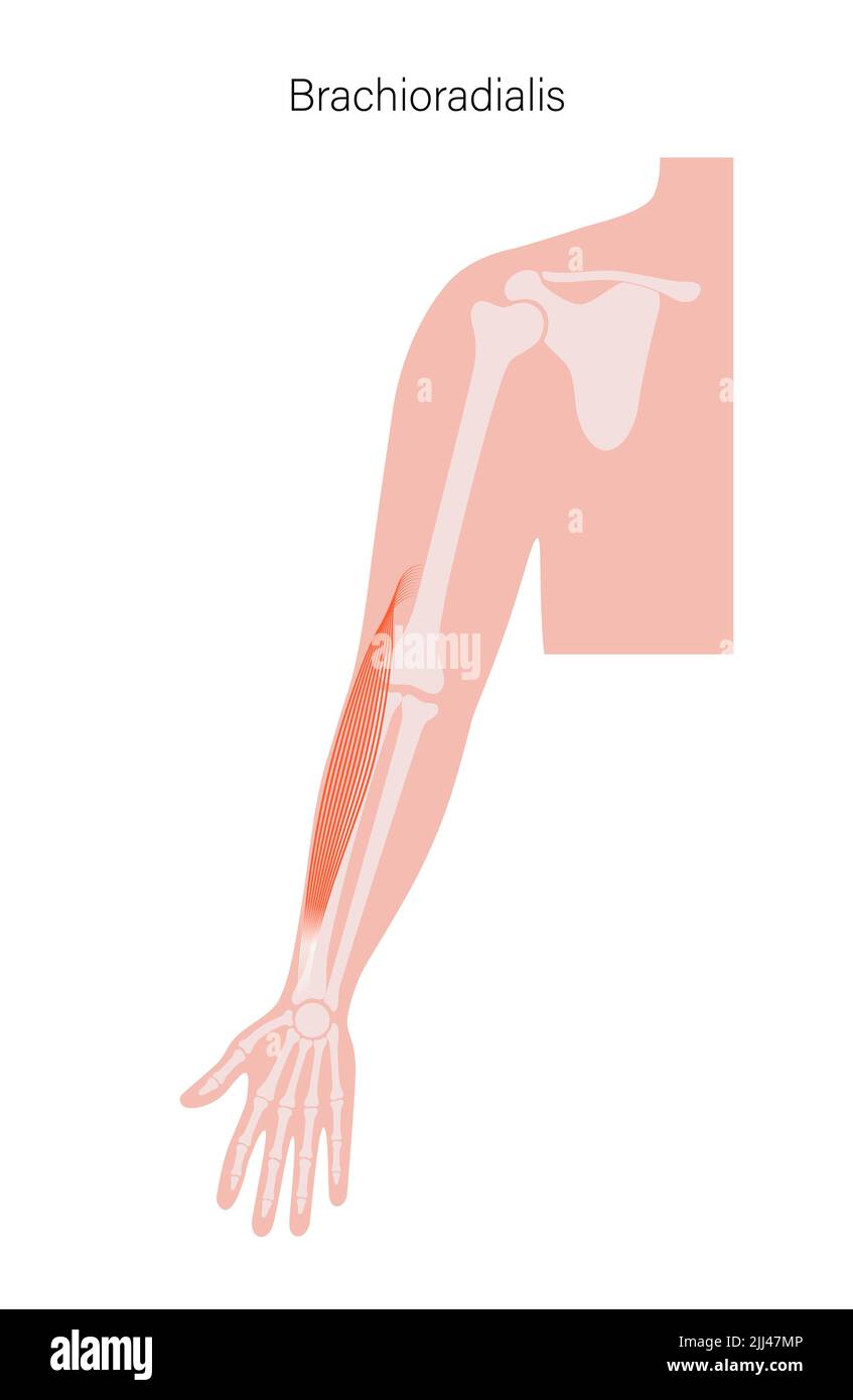 Pronator Teres And Brachioradialis