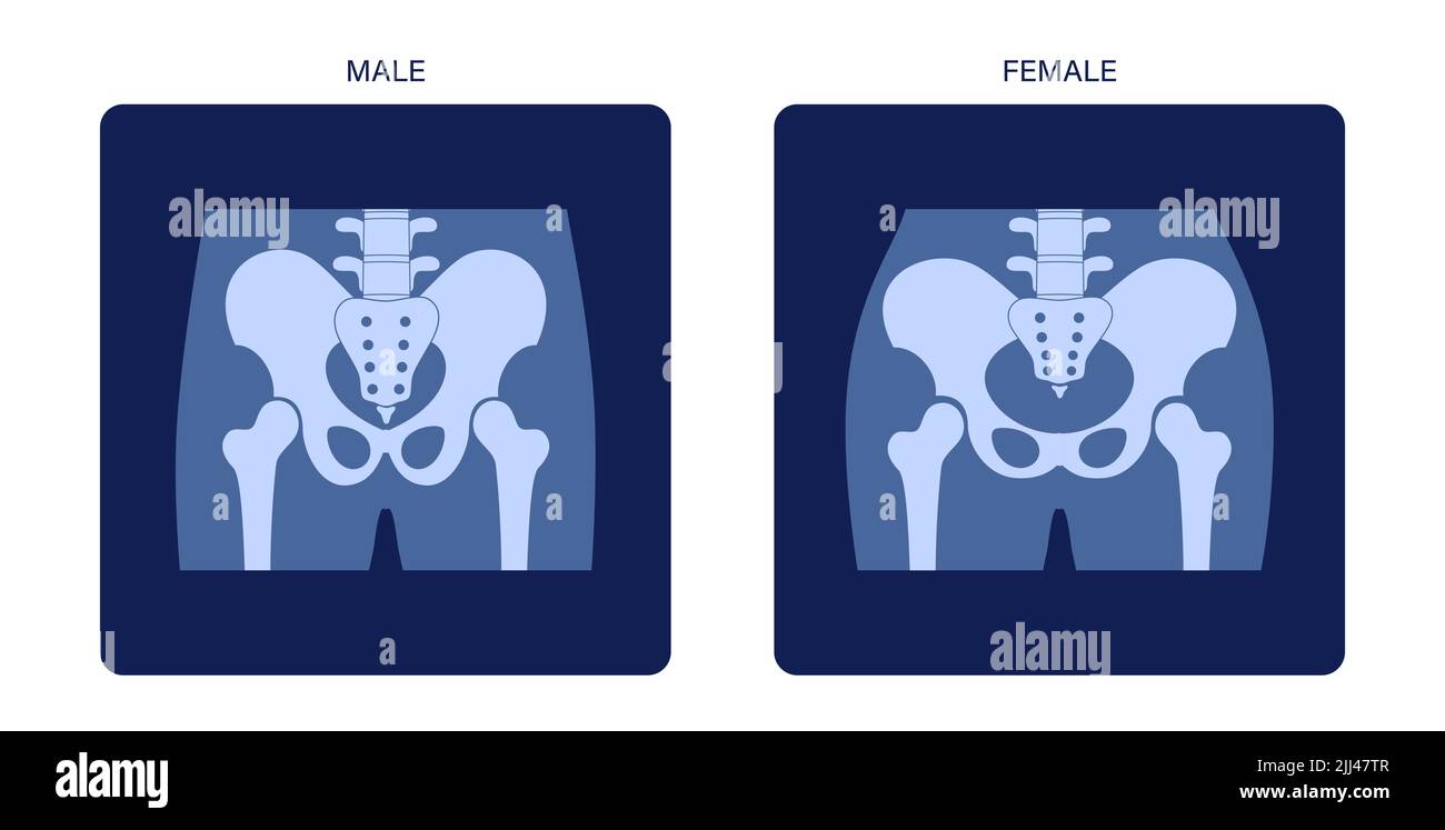 Pelvis anatomy, illustration Stock Photo - Alamy