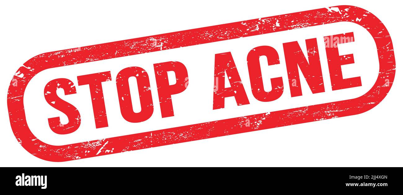 STOP ACNE, text on red rectangle stamp sign Stock Photo - Alamy