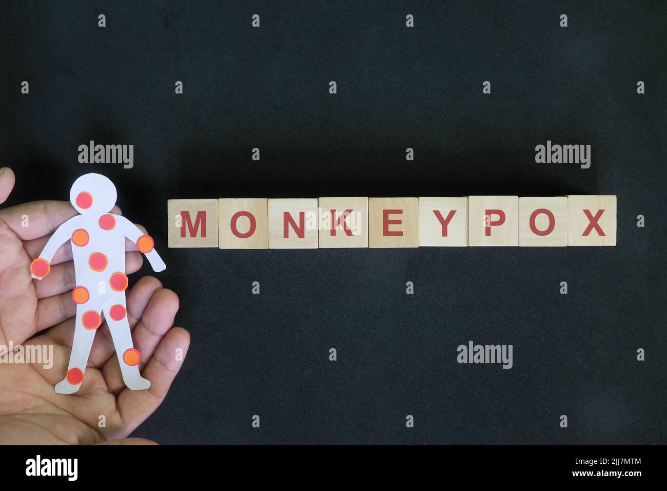 Monkeypox disease outbreak care, prevention and protection concept ...