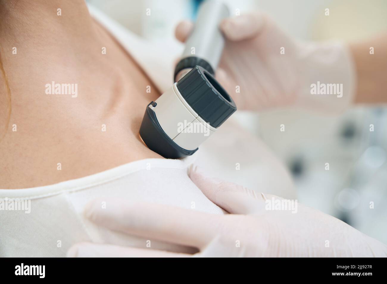 Diagnosis of neoplasms, moles with a dermatoscope, close-up Stock Photo ...