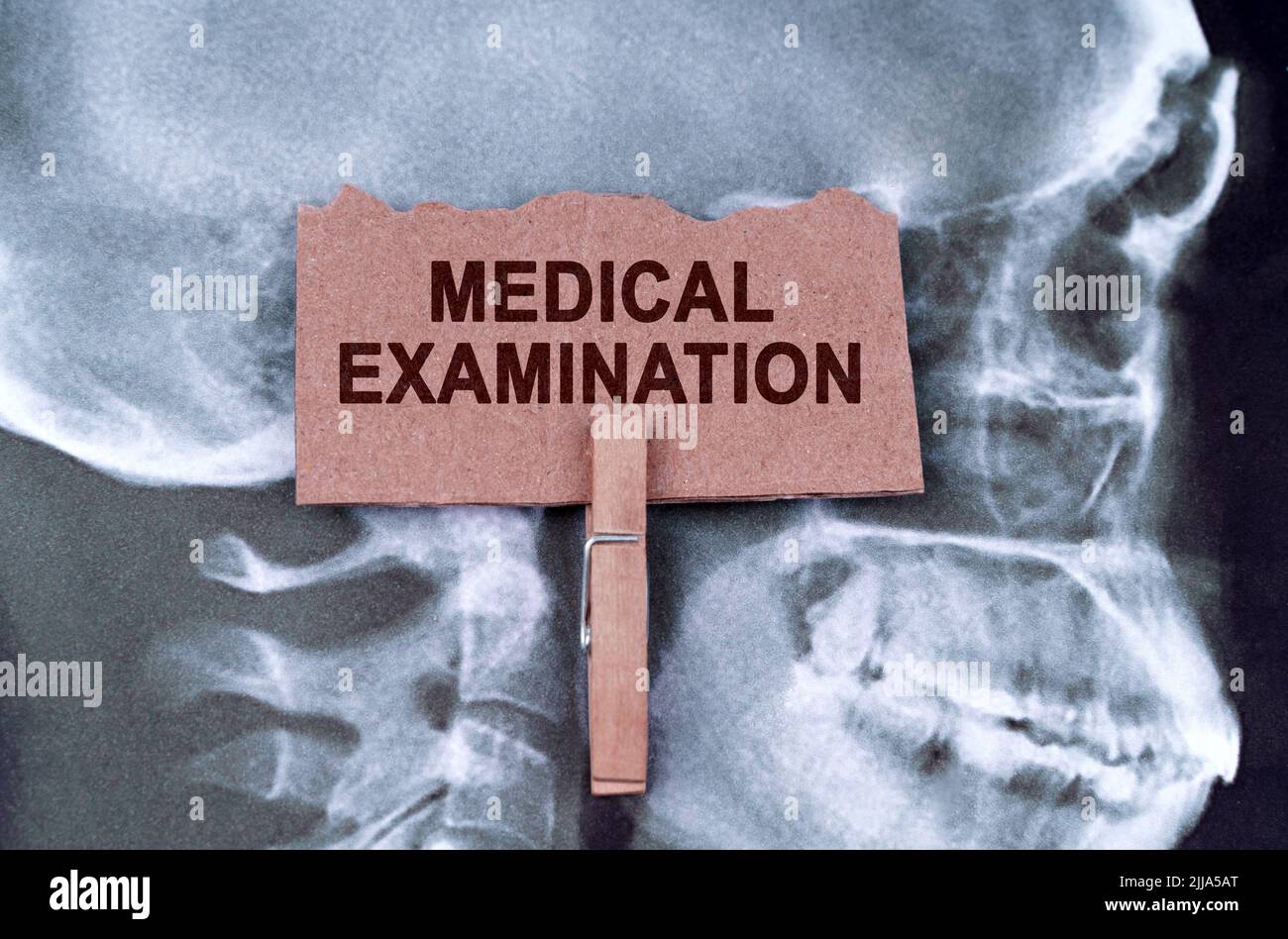 Medicine concept. Against the background of an X-ray of the skull, a ...