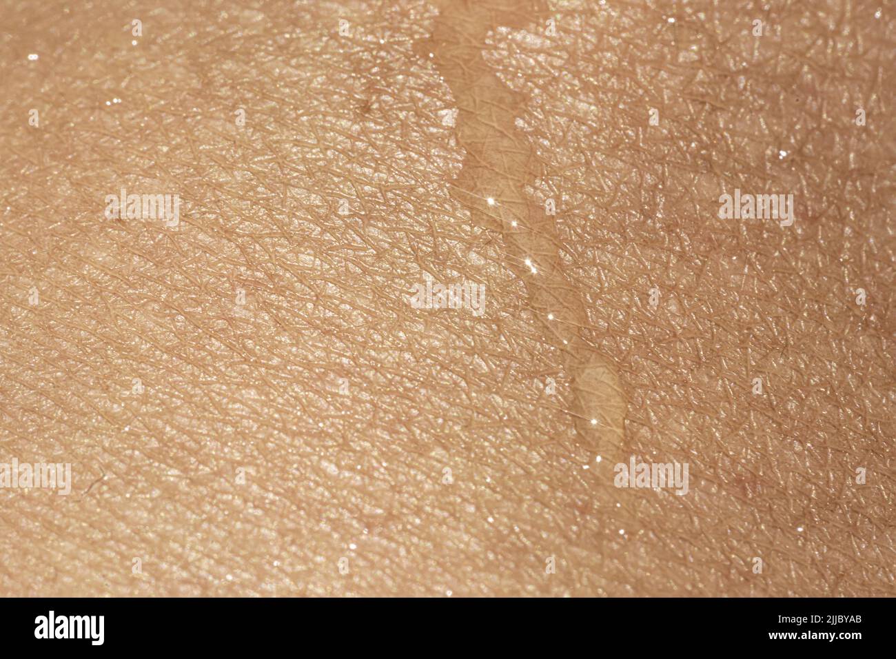 White Human Skin Texture