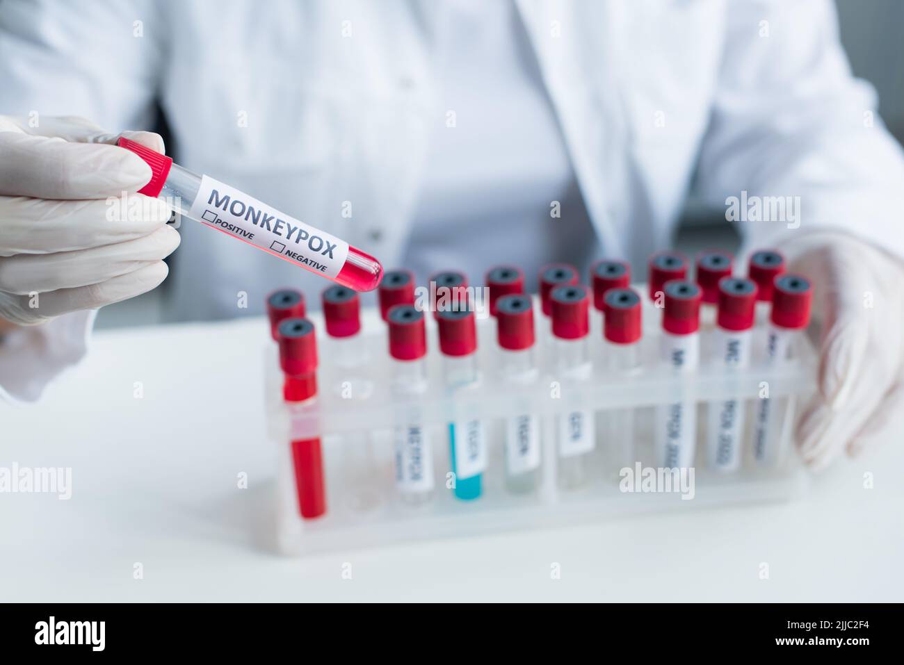 Cropped view of blurred scientist holding test tube with monkeypox ...