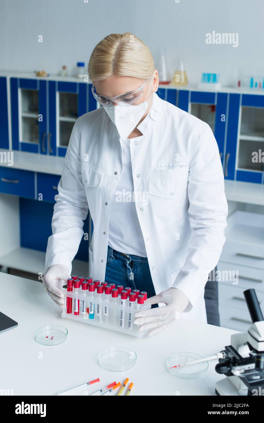 Scientist holding test tubes with monkeypox lettering near microscope ...