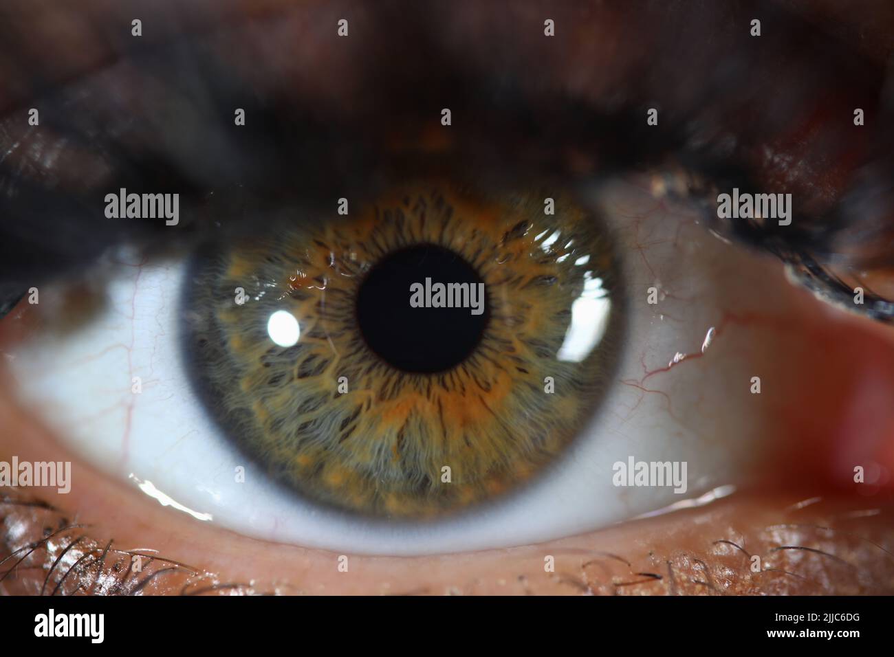 Iris ‘green spot’ hi-res stock photography and images - Alamy