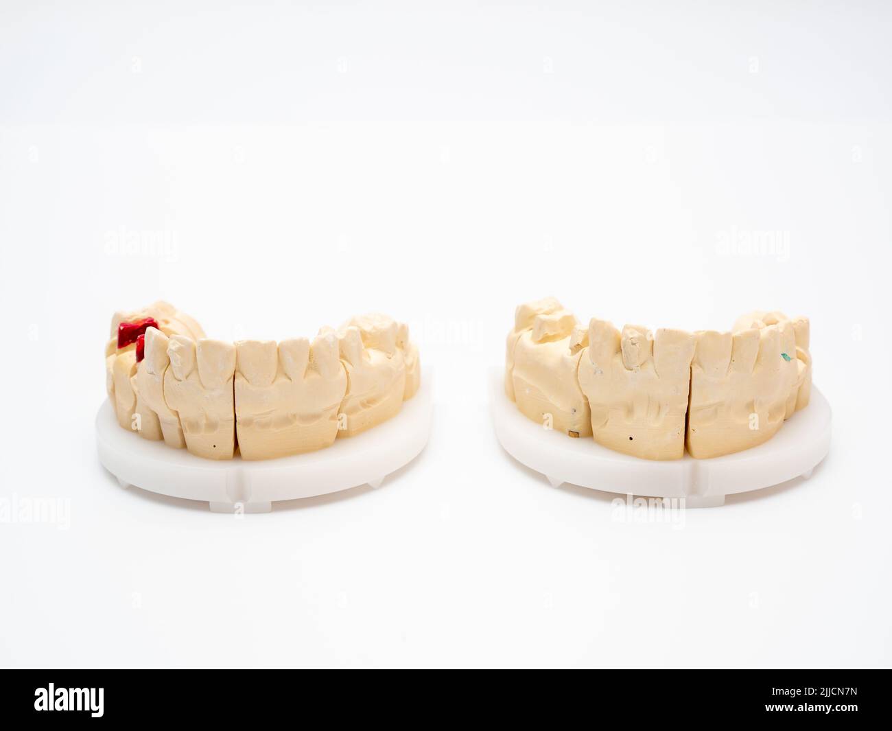 Plaster model or cast of human teeth. Teeth model on a white background ...