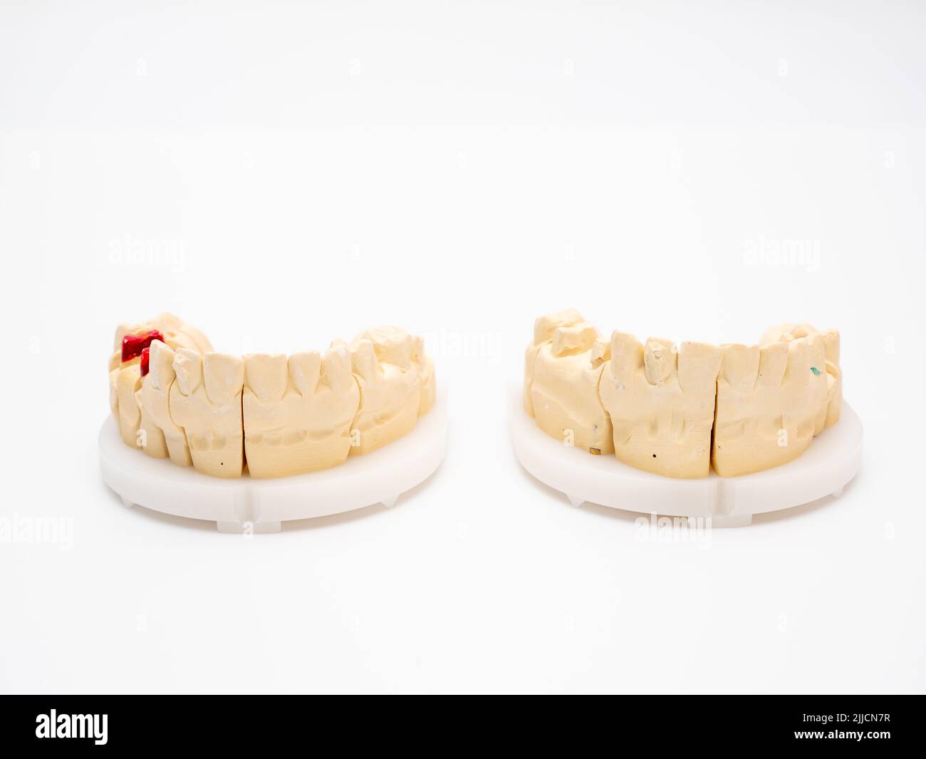 Plaster model or cast of human teeth. Teeth model on a white background ...