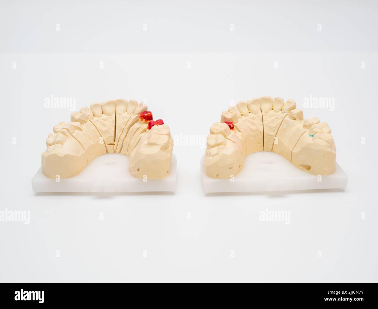 Plaster model or cast of human teeth. Teeth model on a white background ...