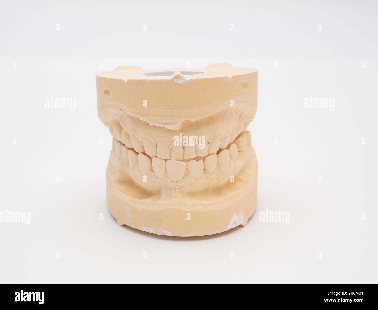 Plaster model or cast of human teeth. Teeth model on a white background ...