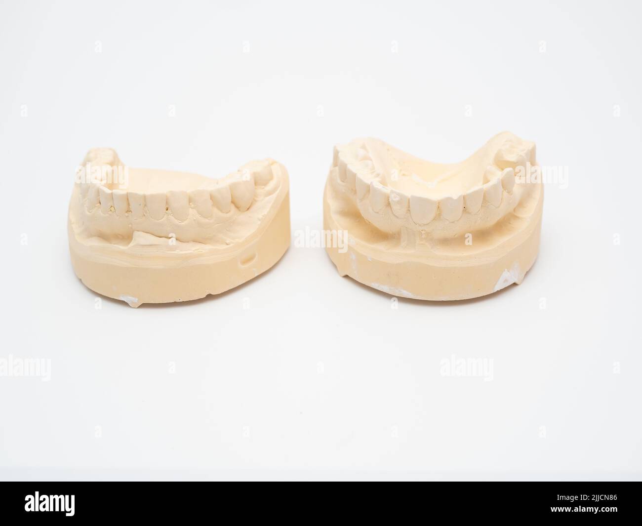Plaster model or cast of human teeth. Teeth model on a white background ...