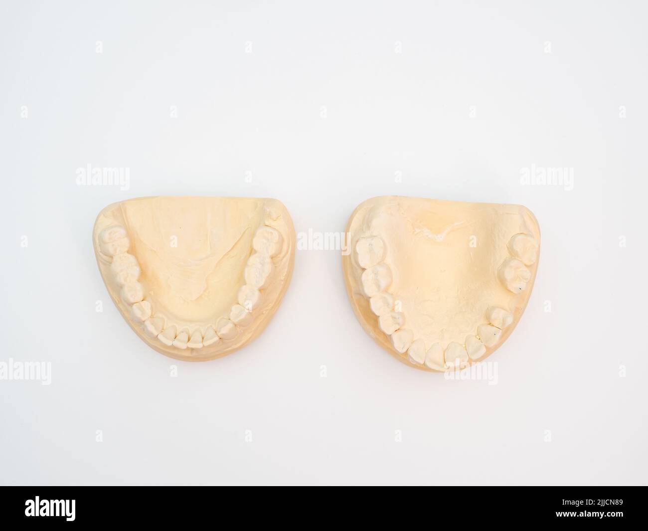 Plaster model or cast of human teeth. Teeth model on a white background ...