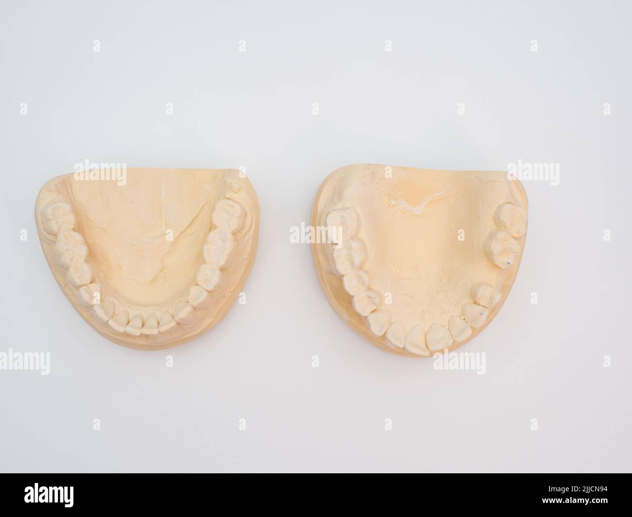 Plaster model or cast of human teeth. Teeth model on a white background ...