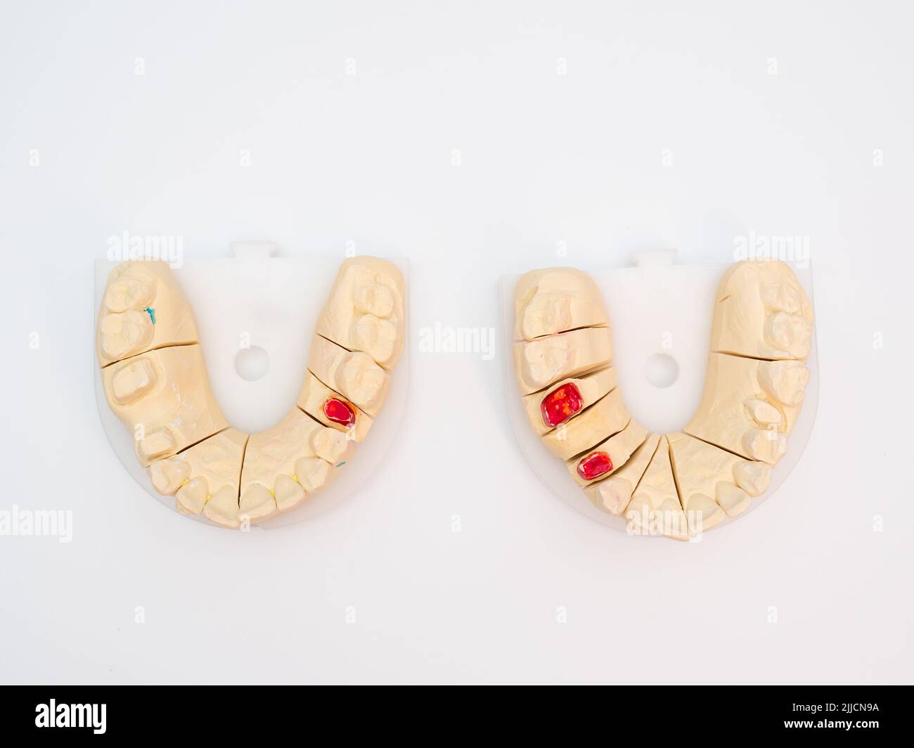Plaster model or cast of human teeth. Teeth model on a white background ...