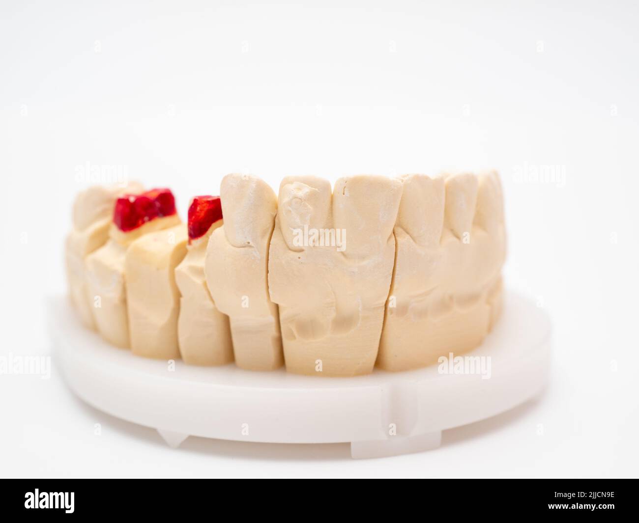 Plaster model or cast of human teeth. Teeth model on a white background ...