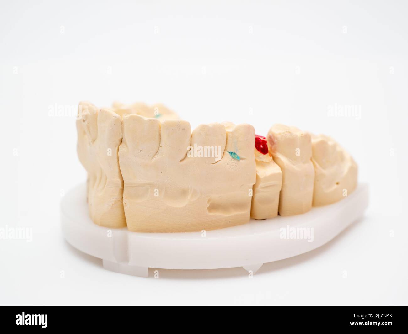 Plaster model or cast of human teeth. Teeth model on a white background ...