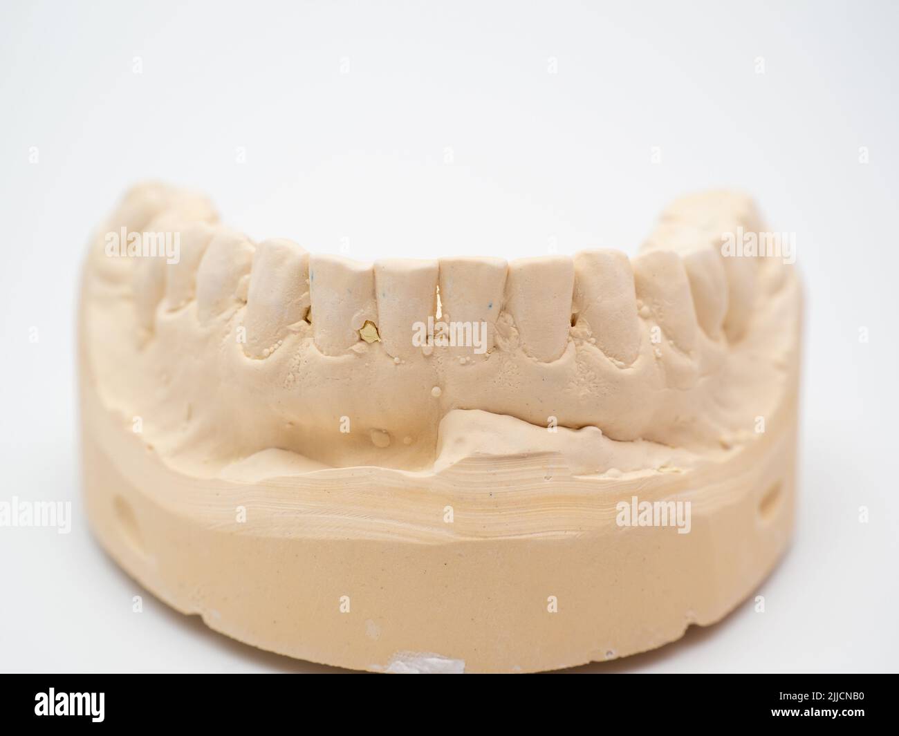 Plaster model or cast of human teeth. Teeth model on a white background ...