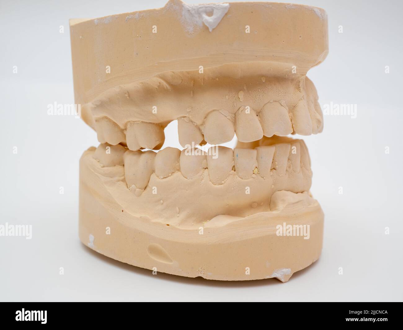 Plaster model or cast of human teeth. Teeth model on a white background ...
